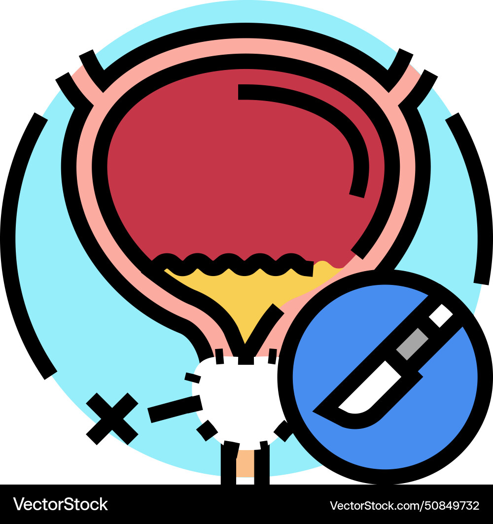 Prostatectomy urology color icon Royalty Free Vector Image