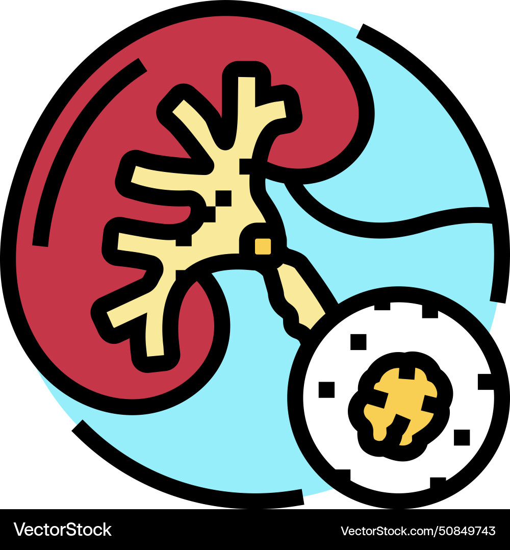 Urolithiasis urology color icon Royalty Free Vector Image