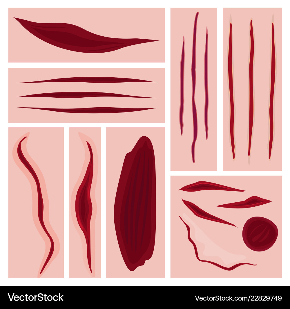 Set of cuts scars bruises Royalty Free Vector Image