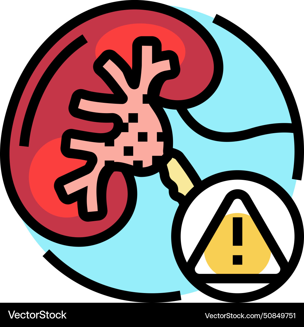 Hydronephrosis urology color icon Royalty Free Vector Image
