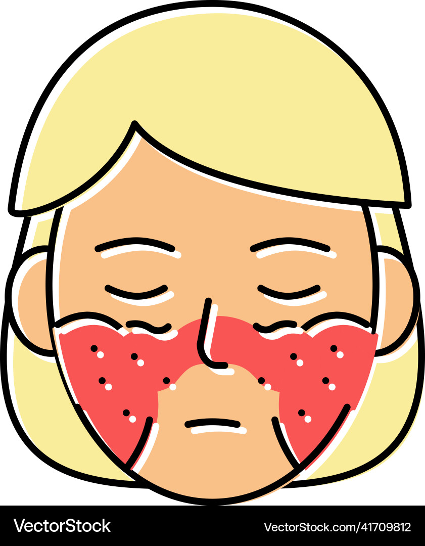 Systemic lupus erythematosus color icon Royalty Free Vector