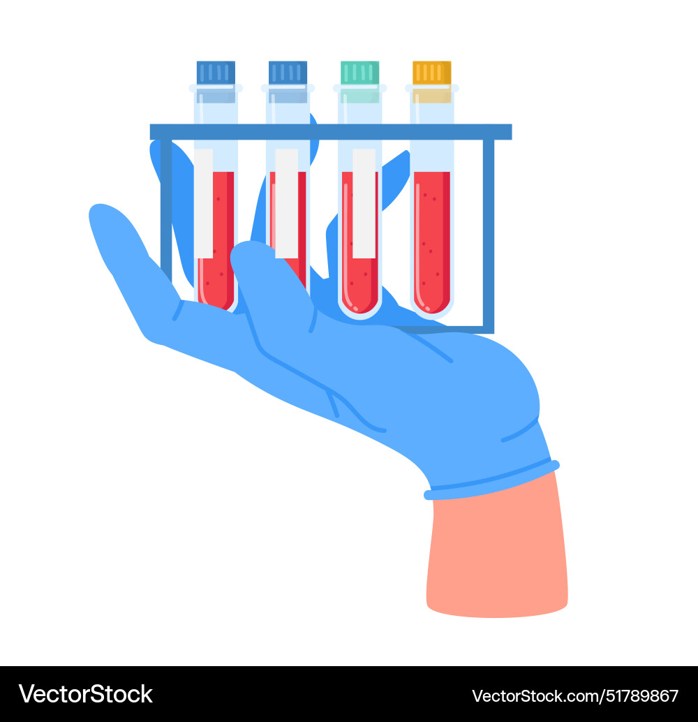 Lab worker hand holding blood samples doctor Vector Image