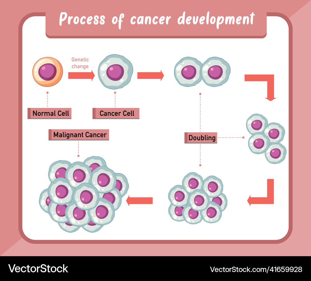 Process of cancer development infographic Vector Image