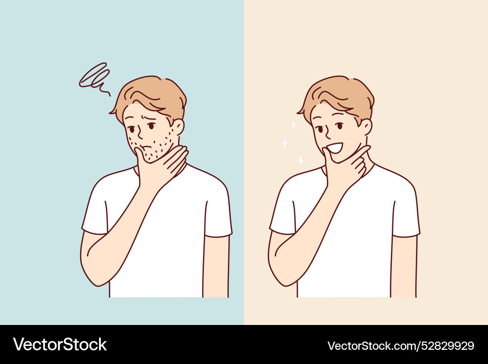 Pimples and spots on man face disappeared after Vector Image