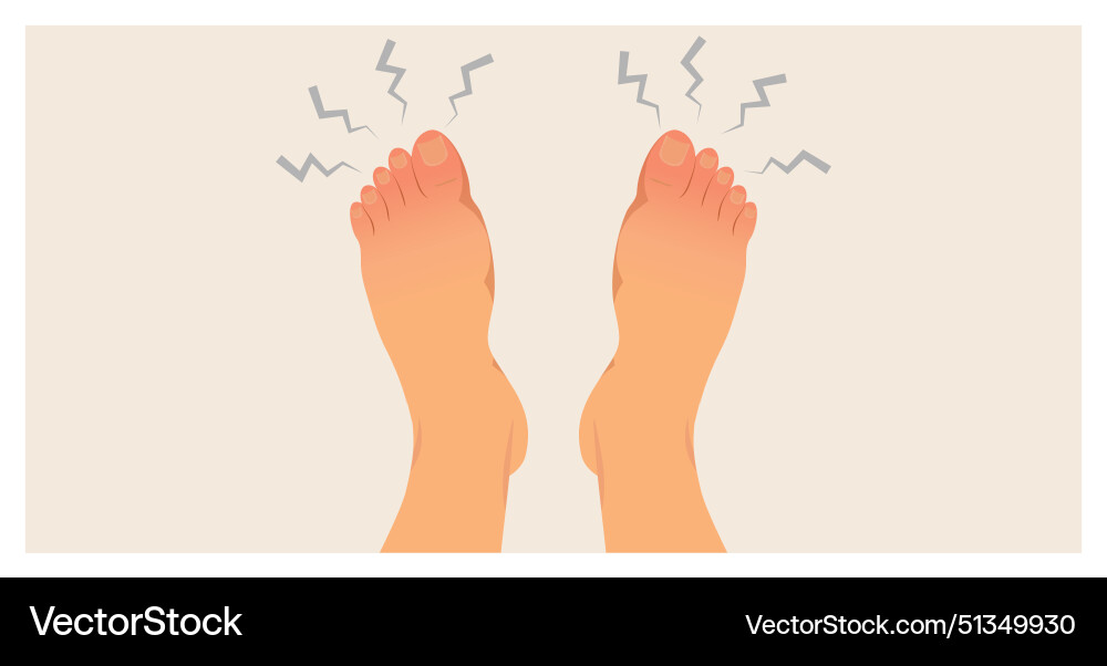 Swollen feet or numb feeling tingly Royalty Free Vector