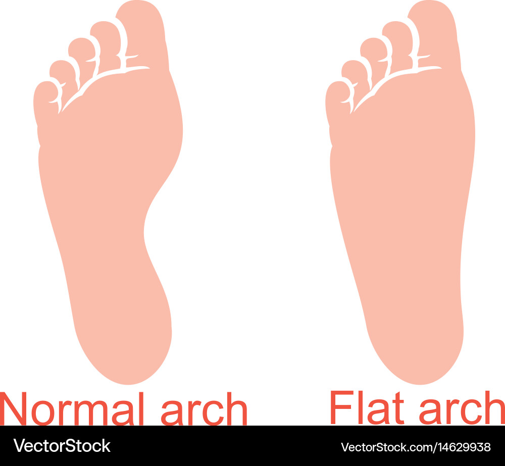 Human anatomy flat and normal arch Royalty Free Vector Image