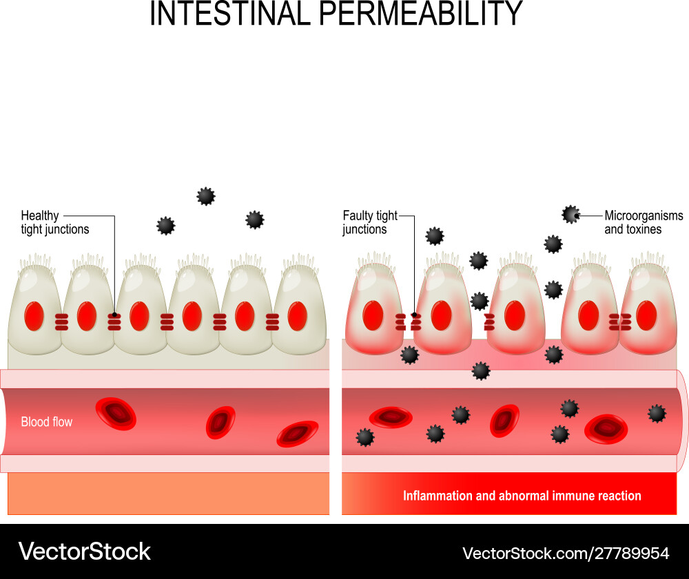 Leaky Gut Intestinal Permeability Royalty Free Vector Image