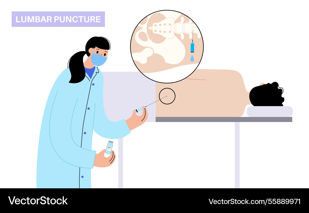 Lumbar Puncture Procedure Royalty Free Vector Image