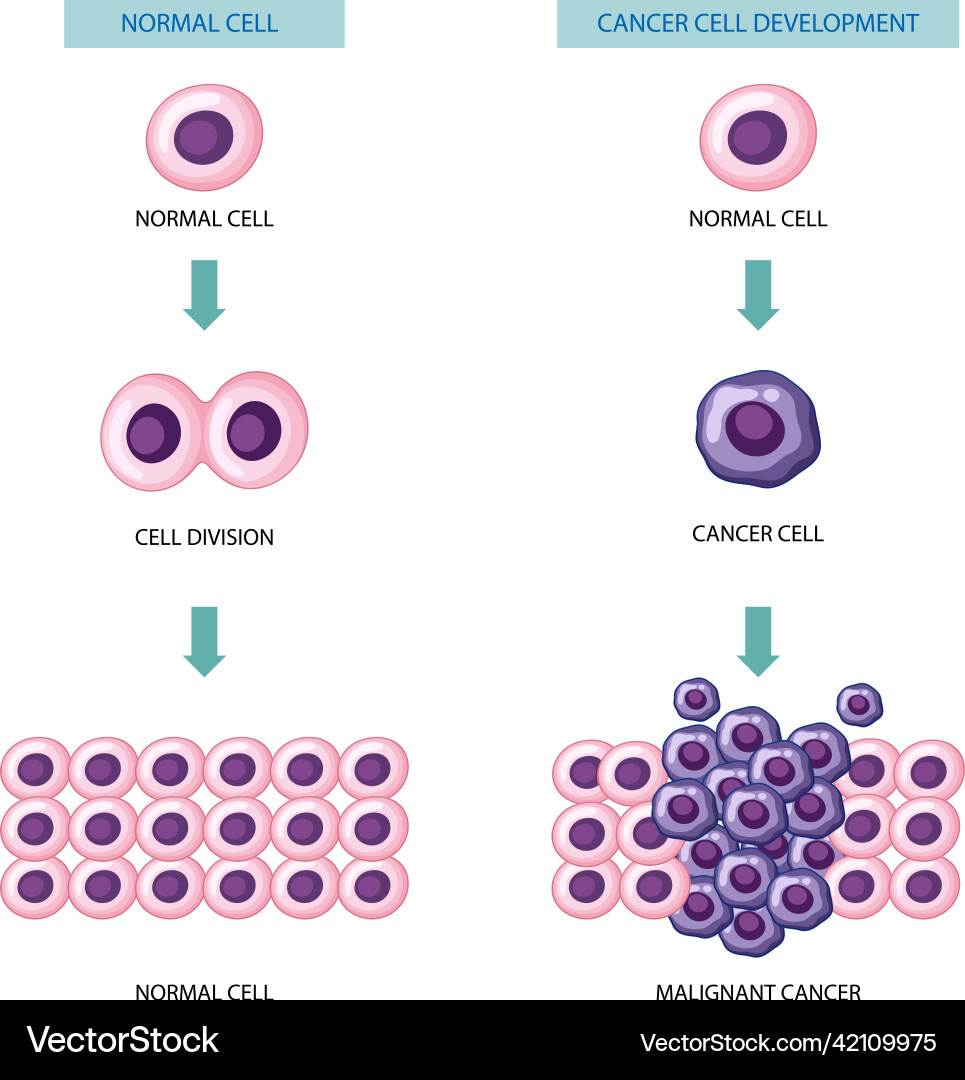 Process of cancer cell development Royalty Free Vector Image