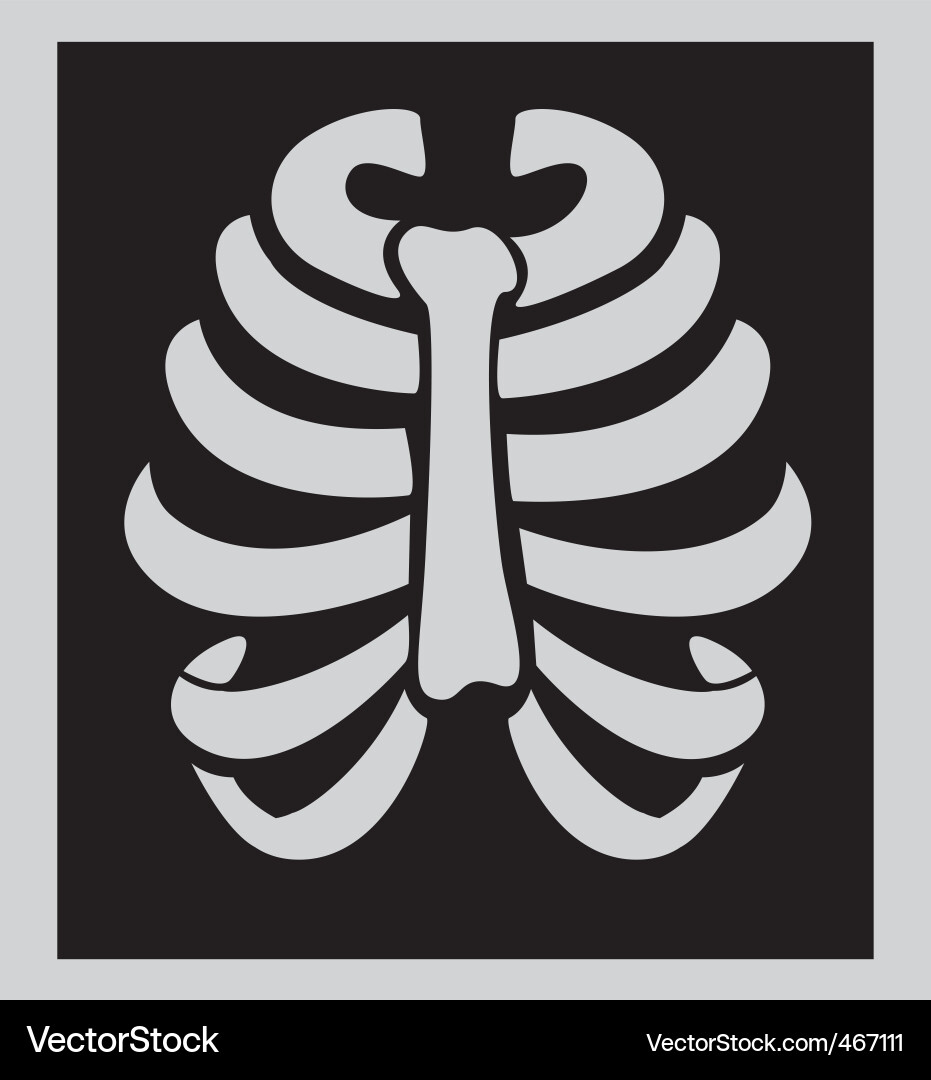 X-ray chest Royalty Free Vector Image - VectorStock