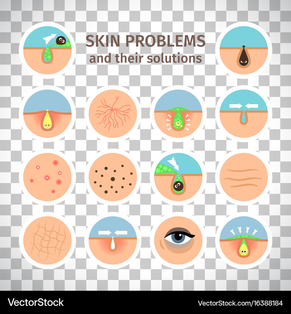 Skin problem icons on transparent background Vector Image