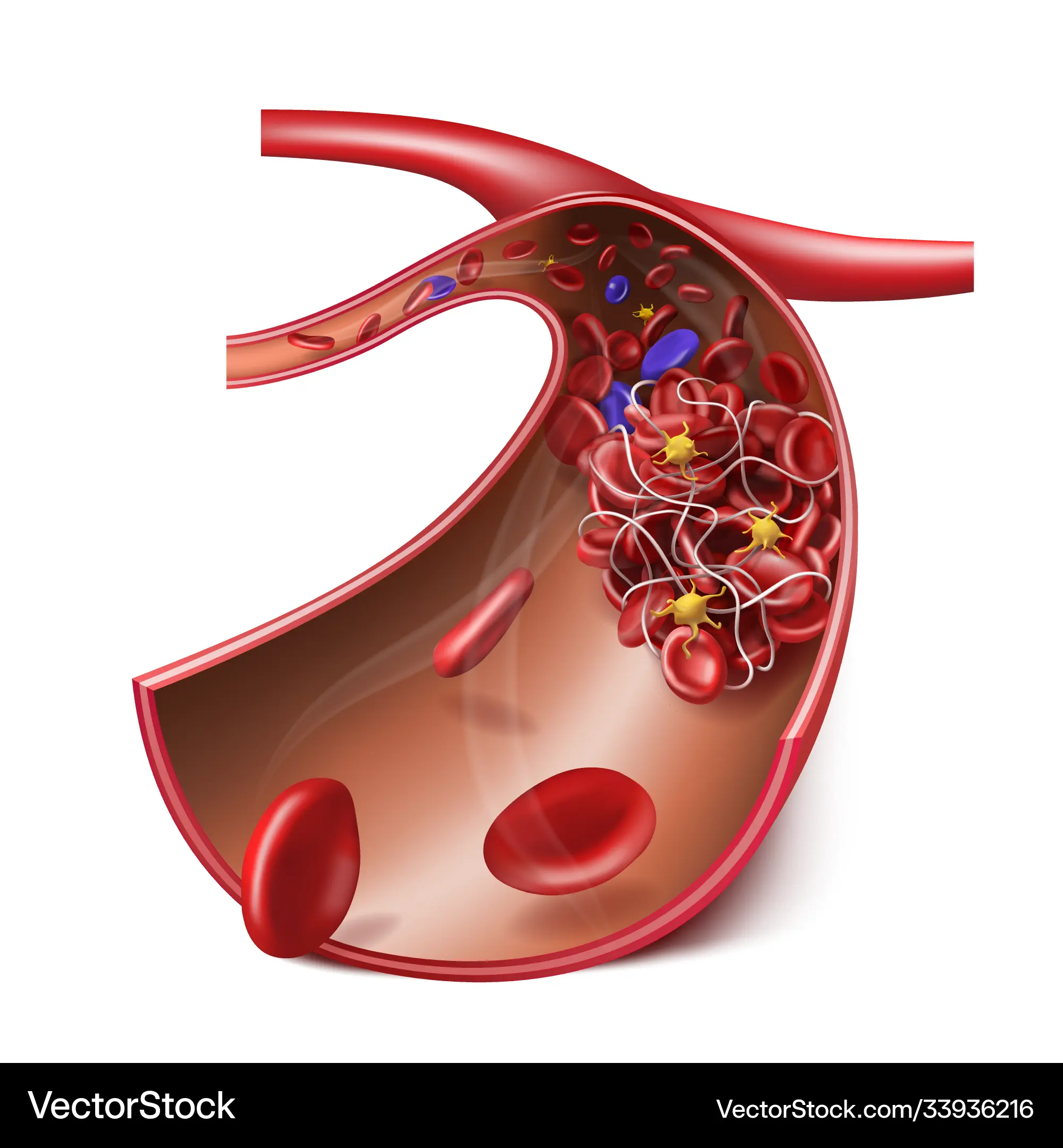 Clot Symbol designs, themes, templates and downloadable graphic🕑 ...