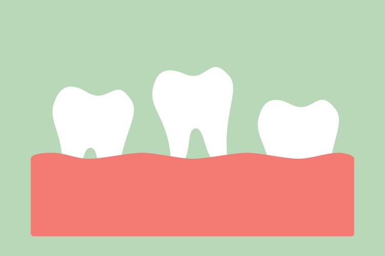 Cartoon Missing Tooth Vector Images (over 150)