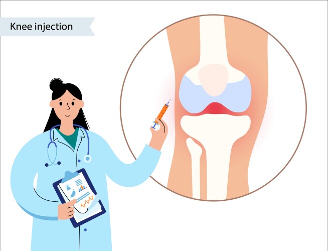 Knee joint nutritional elements diagram Royalty Free Vector