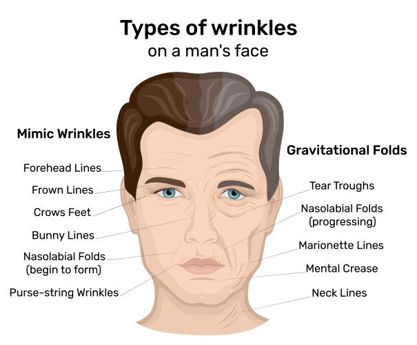 Forehead Wrinkles Vector Images (over 330)