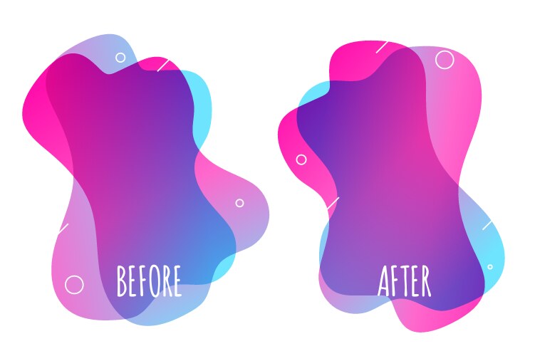 Before and After Template Vector Images (over 360)