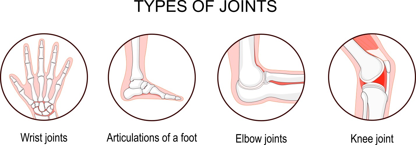 Gangrene affecting the toes tissue death Vector Image