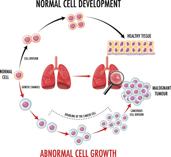 Diagram showing cancer development process Vector Image