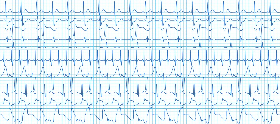 Ecg tracing Vector Images & Graphics for Commercial Use | VectorStock