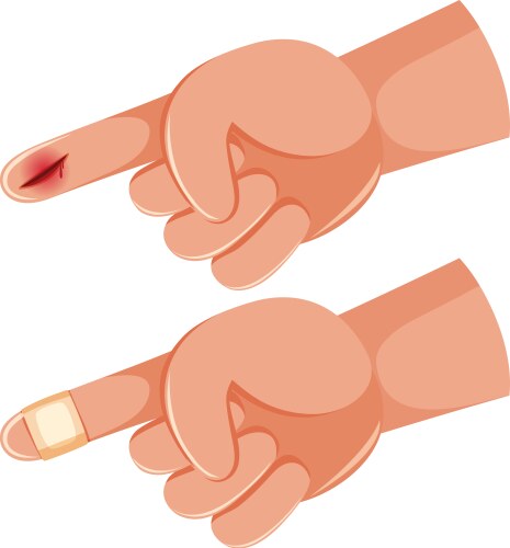 Hand Injury Vector Images (over 16,000)