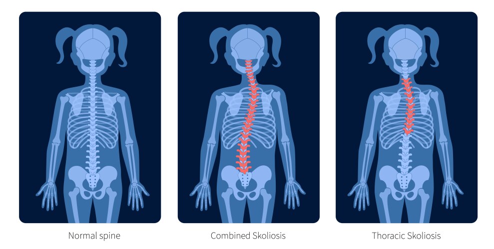 Spine Vector Images (over 32,000)