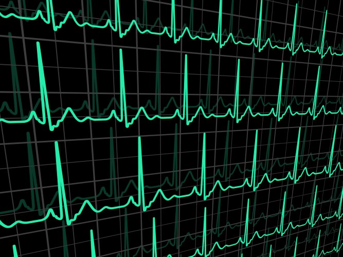 Normal electrocardiogram ecg eps 8 Royalty Free Vector Image