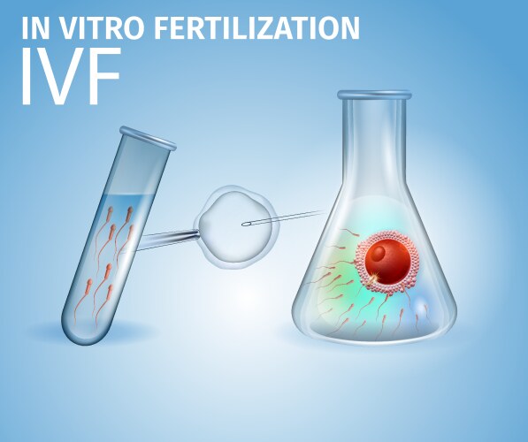 Ivf Vector Images (over 1,400)