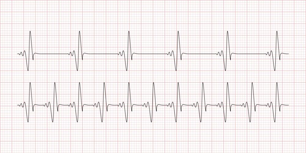 Heartbeat Vector Images (over 71,000)