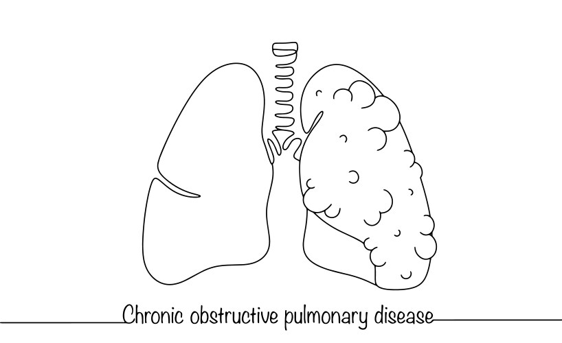 Lung Vector Images (over 48,000)