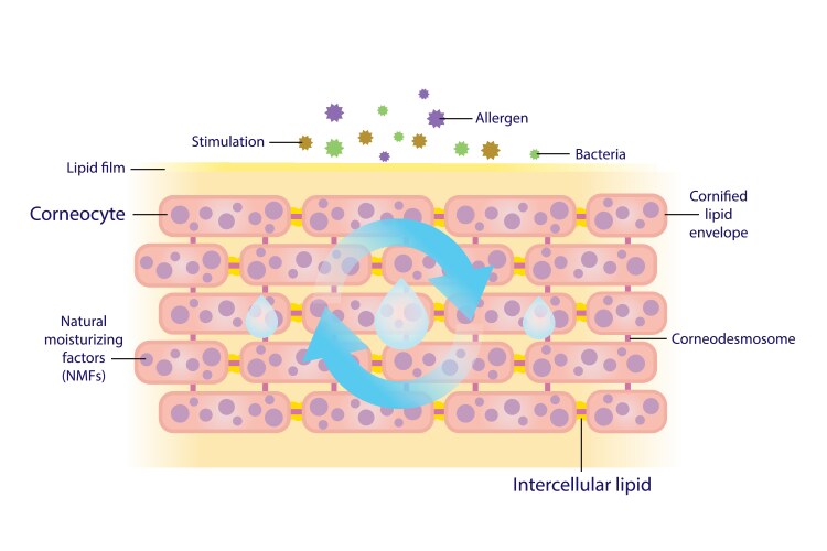 Mechanism of dehydration skin Royalty Free Vector Image