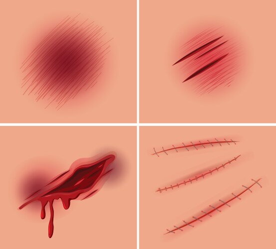 Isolated hand open wound Royalty Free Vector Image