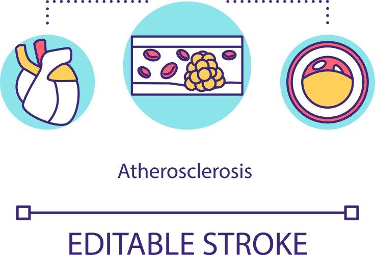 Atherosclerosis stage icon set anatomy of heart Vector Image
