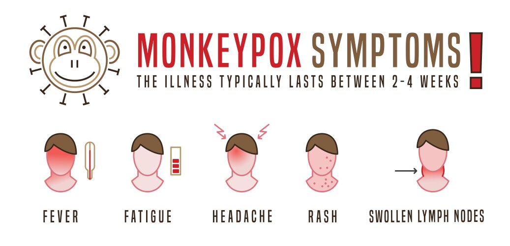 Monkeypox virus infographics symptoms and useful Vector Image