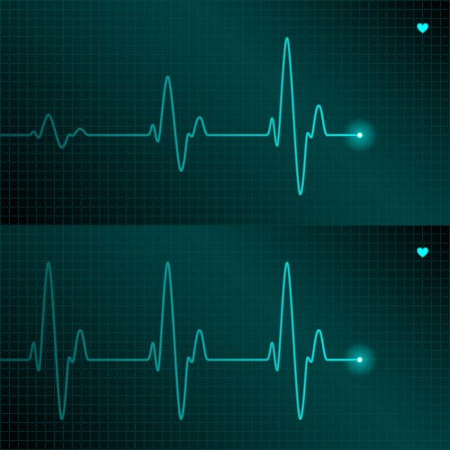 Tracing Vector Images (over 87,000)