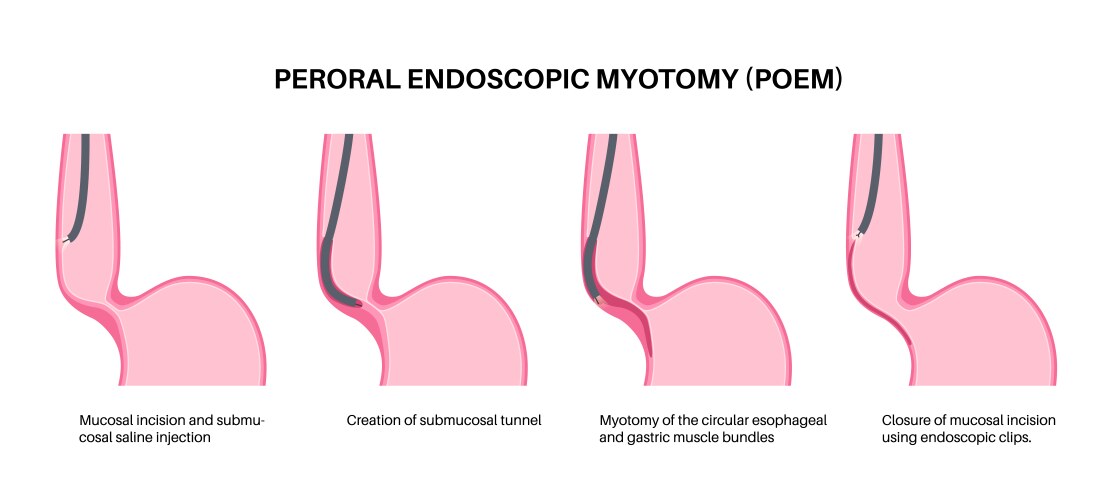 Poem medical poster Royalty Free Vector Image - VectorStock