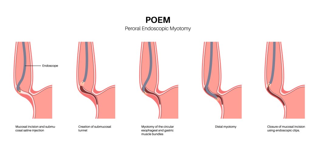 Poem medical poster Royalty Free Vector Image - VectorStock
