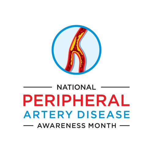 Peripheral Arterial Vector Images (83)