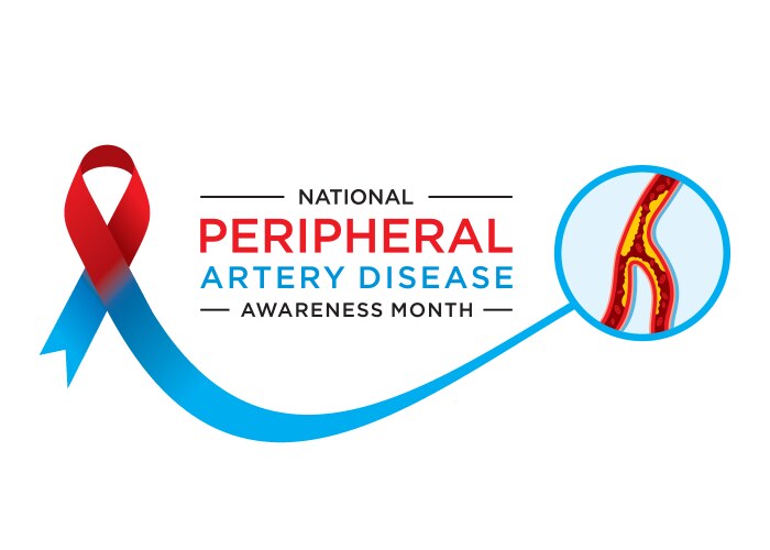 Peripheral Arterial Vector Images (83)