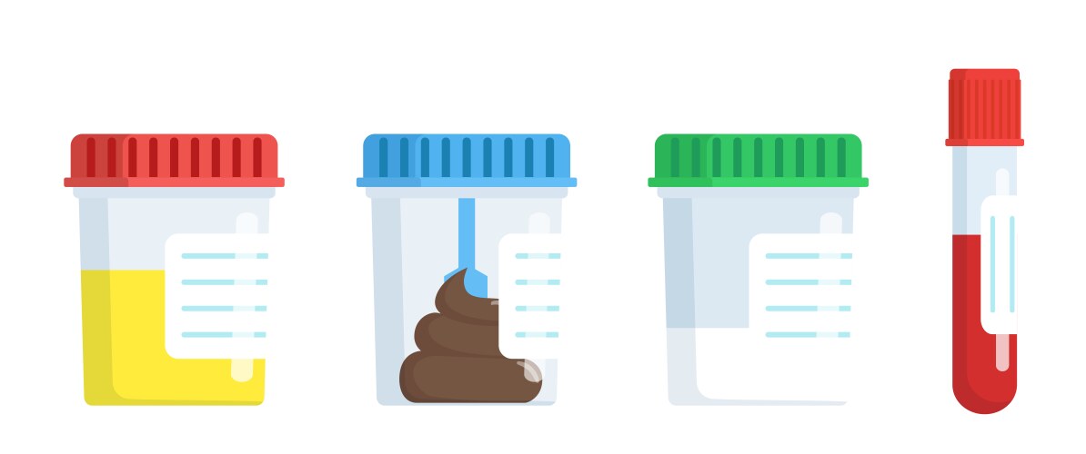 Urine color chart in test tubes medical Royalty Free Vector