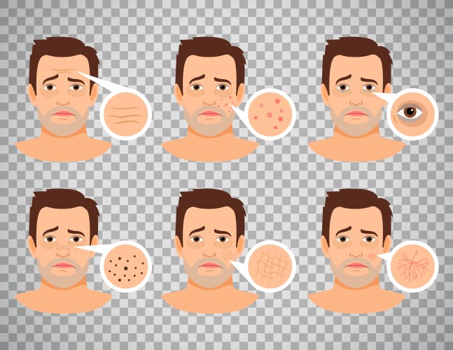Young man face problem wrinkles Royalty Free Vector Image