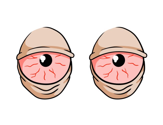 Red hand-drawn eyes problem of insomnia Royalty Free Vector