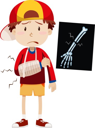 Boy cartoon broken arm and leg Royalty Free Vector Image