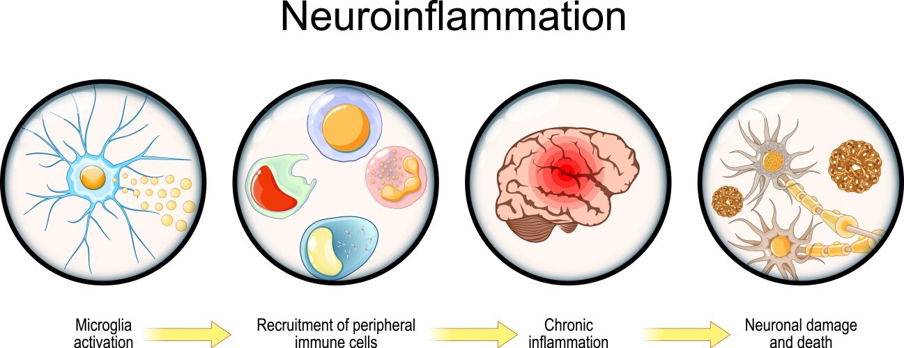 Neuroinflammation Vector Images (17)