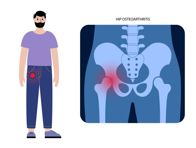 Hip Pain Vector Images (over 3,000)