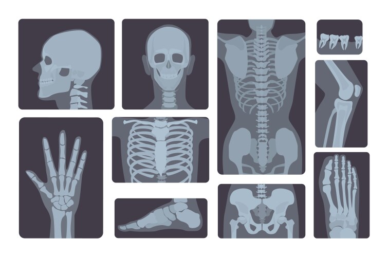 Different x-rays shot human body part set Vector Image