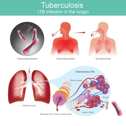 Pulmonary alveoli gas exchange in a lungs Vector Image