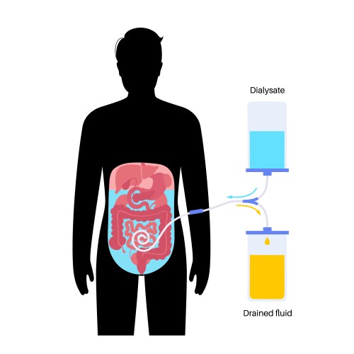 Peritoneum Vector Images (over 100)