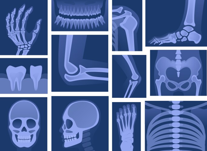 Skeleton Body Parts Vector Images (over 2,500)