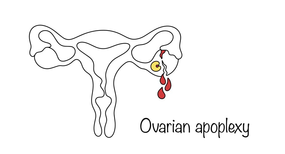 Molluscum contagiosum Royalty Free Vector Image