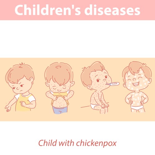 Chicken pox symptoms infographic Royalty Free Vector Image
